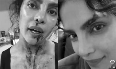 زخموں سے چور پریانکا چوپڑا کی تصاویر نے مداحوں کو پریشان کر دیا Life