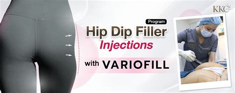 Hip Dip Filler In Bangkok With Variofill Kkc Clinic