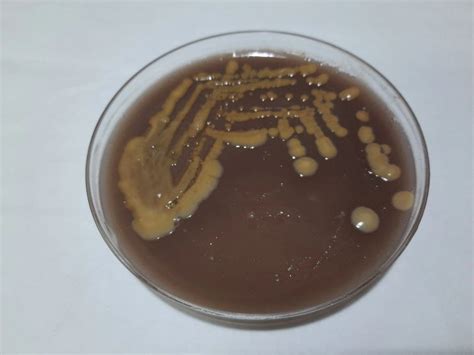 Cryptococcus Neoformans Var Grubii Colony On Bsa Ajay Kumar Chaurasiya Posted On The Topic
