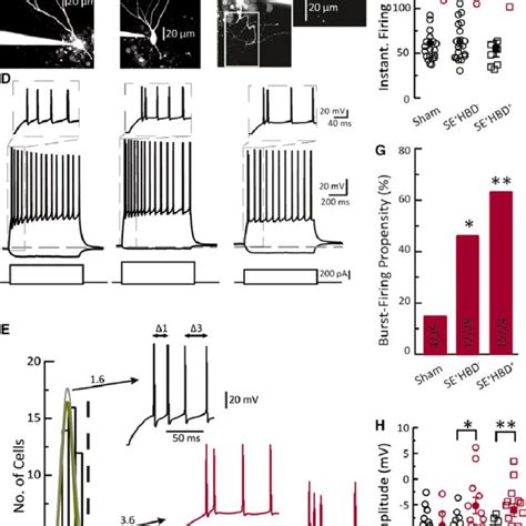 Passive Membrane Properties Of Immature Granule Cells Individual