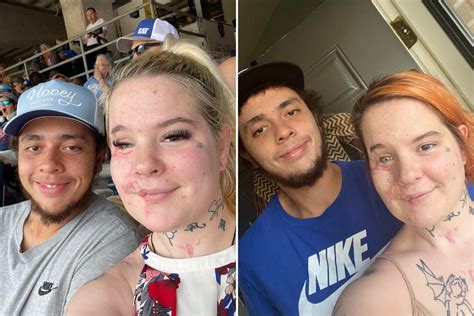My Ex Shot Me In The Face—now I Warn Others How To Spot Abusive