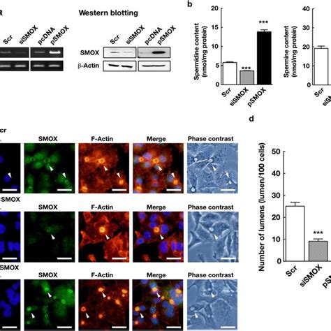 Smox Akt Pathway And Acrolein Are Required For Bile Canalicular Lumen