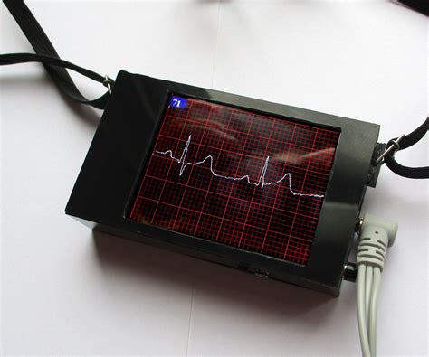Ecg Display With Arduino 13 Steps With Pictures Instructables