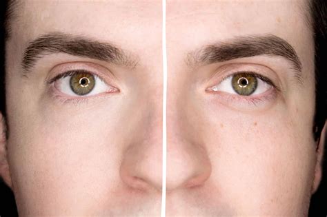 Under Eye Brightening With Smashbox Before And After Manface