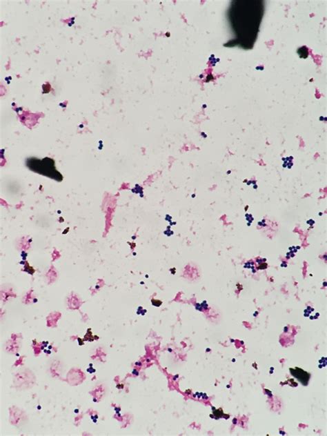 Streptococcus Dysagalactiae グラム染色 Gram Stain