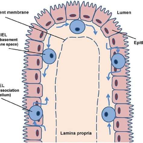 Marsh Oberhuber Classification Of Celiac Disease Download Table