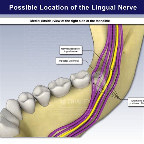Lingual Nerve And Artery