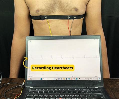 Detecting Heart Beats Using Bioamp Exg Pill 9 Steps With Pictures