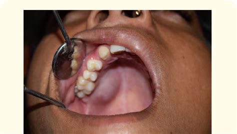 Preoperative Clinical View Contrast Enhanced Computed Tomography Download Scientific Diagram
