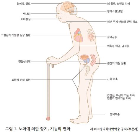 노화 대처법 마치 ‘올드카를 다루듯이