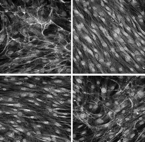 8 Upper Panels Cultured Human Dermal Fibroblasts Immunostained For