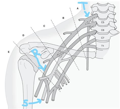 Label The Brachial Plexus Diagram Quizlet