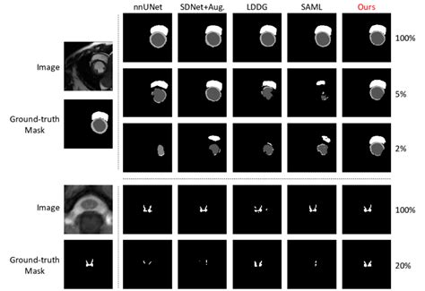 Fig A2 We Show The Example Images And Predicted Segmentation Masks Of Download Scientific