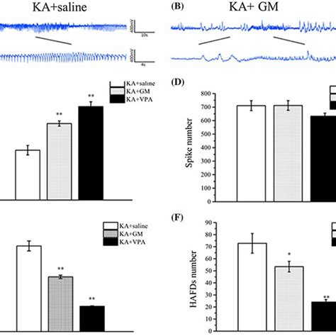 Photomicrographs Of C Fos Immunoreactivity In The Ipsilateral