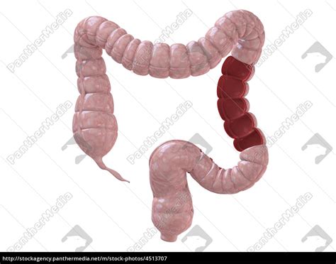 menschliche kolon - Stockfoto - #4513707 | Bildagentur PantherMedia