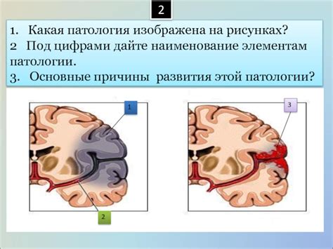Основы патологии
