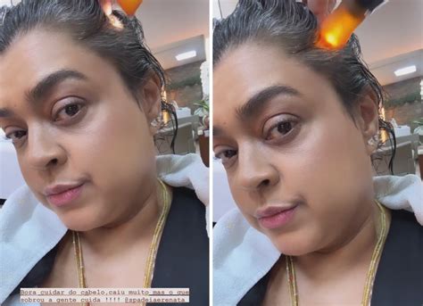 Preta Gil fala sobre queda de cabelo em tratamento contra câncer