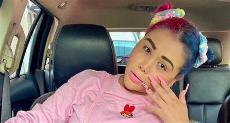 Yina Calderón Mostró Su Cicatriz Luego De Extracción De Biopolímeros