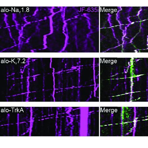 Endosomes Carrying Na V 1 7 Contain Multiple Types Of Membrane Download Scientific Diagram