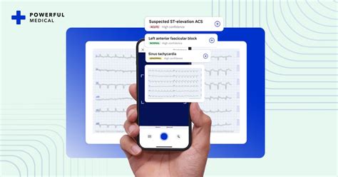 How Is Ai Transforming Ecg Interpretation Ai Ecg
