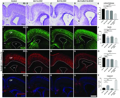 Defects Of Cortical Structure Production Differentiation And Cell