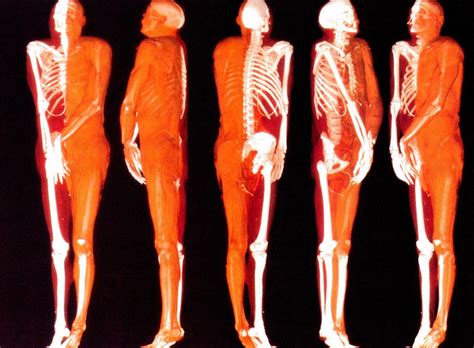 Volume Rendering” Acm Siggraph History Archives