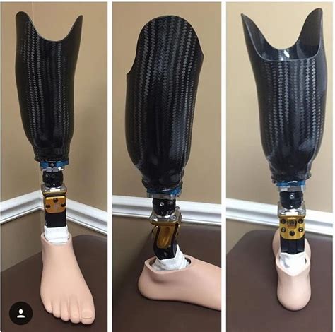 Plastic Below Knee Prosthetic Leg Size Medium At Rs 5599 In Bhopal