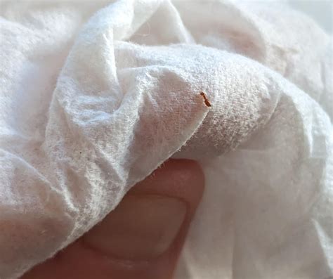 Help Tiny Stinging Bug In My Bed Rwhatsthisbug