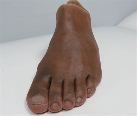 Partial Feet Prostheses Porn Hub Sex