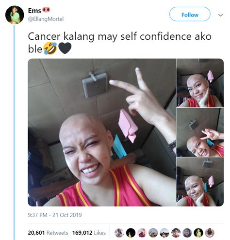 Babaeng May Kanser Kinabiliban Ng Marami Dahil Sa Pagiging Matatag Sa