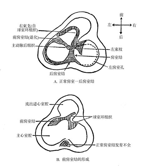 图18 25 前房室结的形成 心脏外科基础图解 医学
