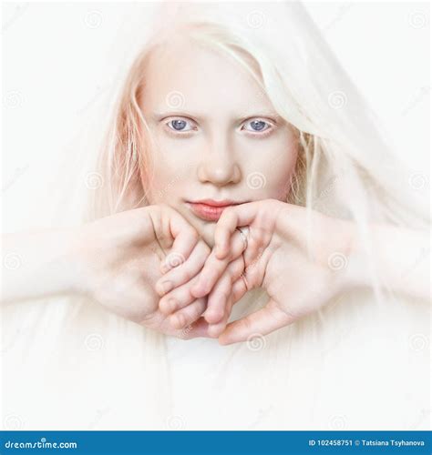 Albino Girl With White Pure Skin Blue Eyes And White Hair Photo Face
