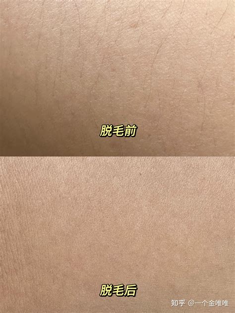 别再花冤枉钱，千元家用脱毛仪功能大盘点！无痛脱毛、冰点脱毛哪家强？人气选手ulike Air3家用脱毛仪真人实测。买前必看不踩坑！ 知乎