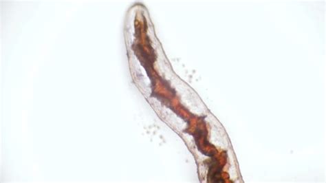 Worm Microscope Stock Footage Royalty Free Video Clips Storyblocks