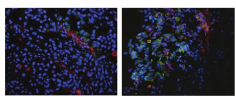 Colocalization Of The Platelet Marker Cd41 Green With A Cd31 Red