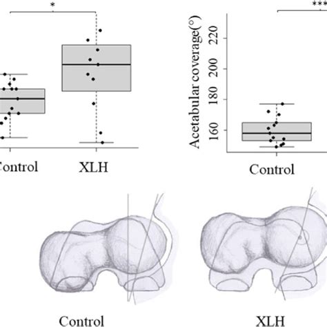 Acetabular Version And Acetabular Coverage For The Two Groups For The