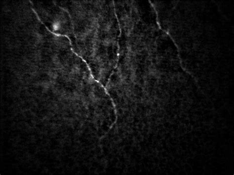 does anyone have information on cornea epithelium segmentation