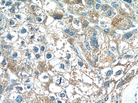 Mkl1 Antibody 21166 1 Ap