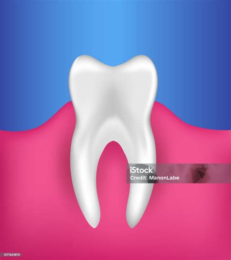 치아 미백 또는 충치 치유 치과 의사 테마 배너 일반적인 구강 건강 문제를 설명하기 위해 뿌리와 분홍색 껌과 현실적인 3d 치아와 포스터 장식 카피 공간이 있는 만화 광고