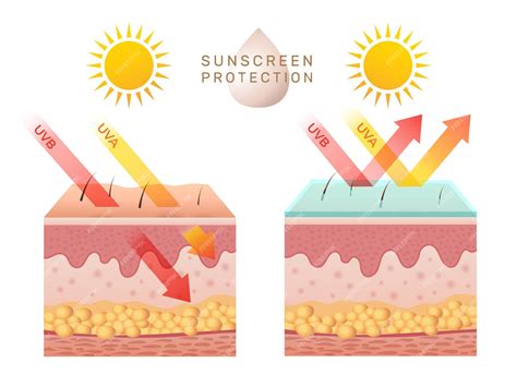 Uv 피부 보호 손상된 인간의 피부는 태양 보호 신체 지방층 표피 최근 벡터 인포그래픽 템플릿 전후에 벗겨집니다 Uv 햇볕에
