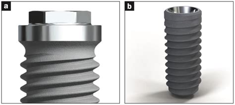 Demystifying Implant Connections Dentistry Today