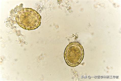 A Variety Of More Serious Stool Abnormalities Check To See Which