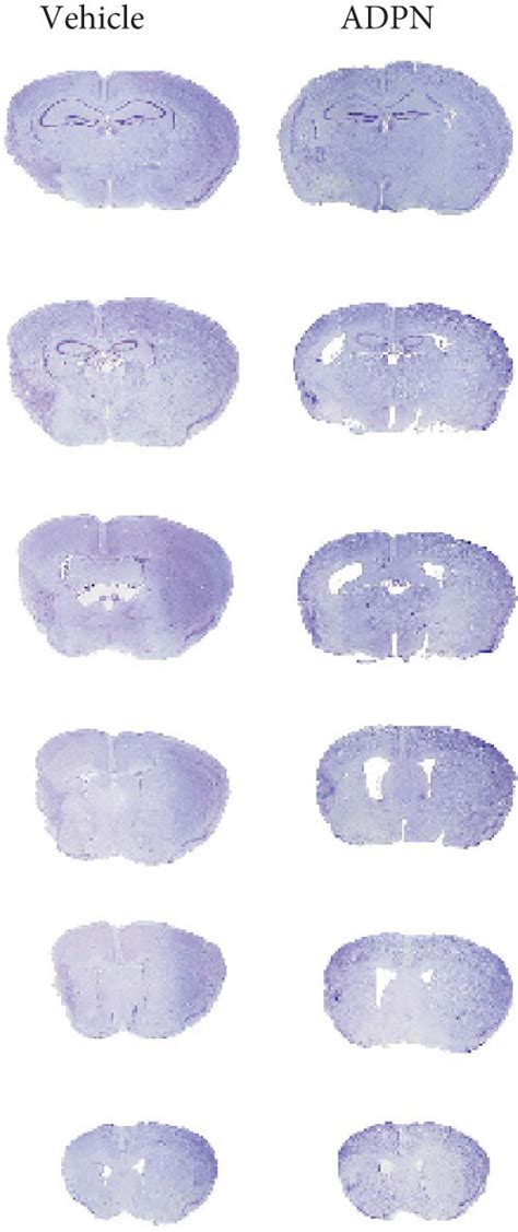 Adpn Promoted Angiogenesis And Improved Long Term Neurobehavioral