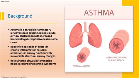 Asthma Pathophysiology And Diagnosis A Synopsis