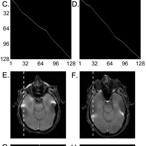Illustration Of Epi Distortion Correction Using Eq 13 A Download Scientific Diagram