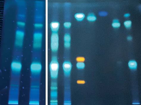 The Chromatogram In Conditions Of Hydroxycinnamic Acids Identifi