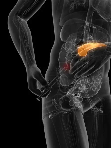 Insulin Injection Artwork F008 2462 Our Beautiful Wall Art And Photo