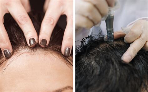 Hair Growth Practices