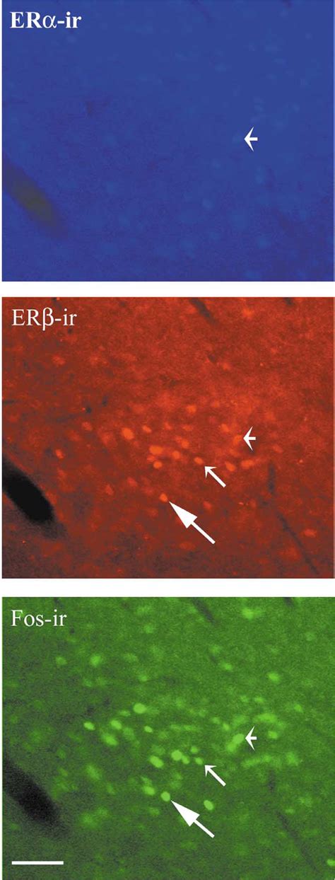 Figure From Response Of ER IR And ER IR Cells In The Forebrain Of