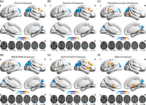 Regions Of Significantly Altered Spontaneous Brain Activity In Six Download Scientific Diagram